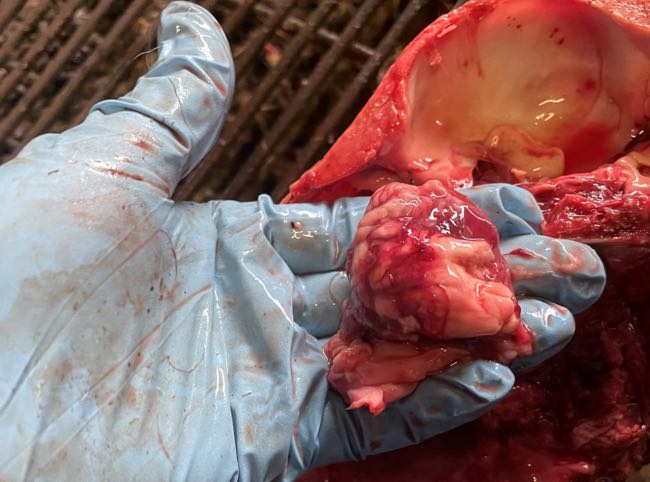 Late-term abortions